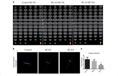 A Voxel Based Statistical Analysis Of The Diffusion Tensor Imaging Download Scientific