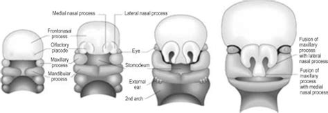 Maxillary Prominence Embryology