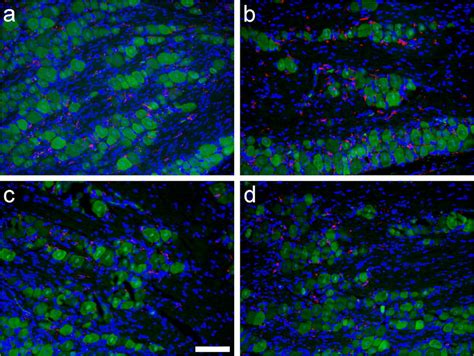 Orofacial Tissue Inflammation Increases While Subsequent Download