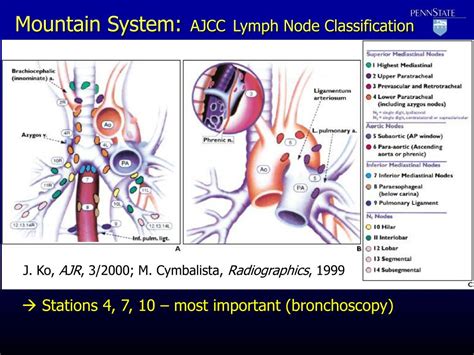 Ppt Extraction And Visualization Of The Central Chest Lymph Node