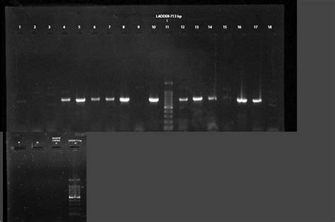 Distribution Of Ctx M Tem Shv Beta Lactamase Gene Among The Klebsiella Pneumoniae Clinical