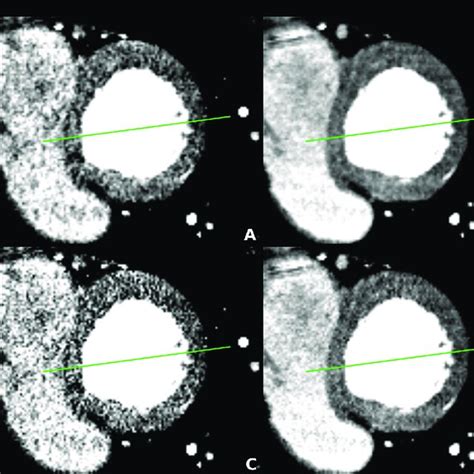 Contour Sharpness Measurement Measurement Of The Contour Sharpness Was Download Scientific