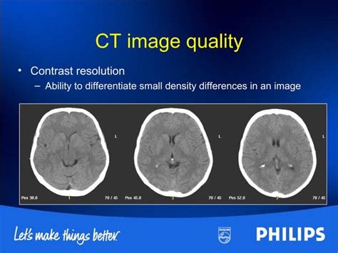 Basic Principles Of Ct Scanning PPT Medical Tests Medical Health