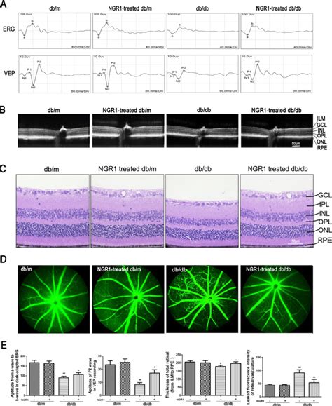 ngr1 pretreatment significantly attenuated dr in db db mice a