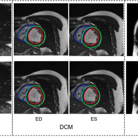 Visualization Of Good Segmentation Examples Selected From Three Patient