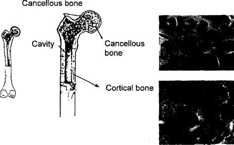 Figure 2 From Optimal Design Of Femoral Hip Prosthesis Using Topology Optimisation To Reduce