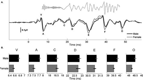 Sex Differences In Auditory Subcortical Function Pmc