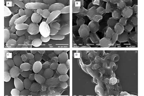 Rare Yeast Pathogen Causing Neonatal Outbreaks The Microbiologist
