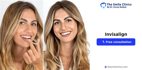 Invisalign Attachments Vs Traditional Braces Which Is Right For You