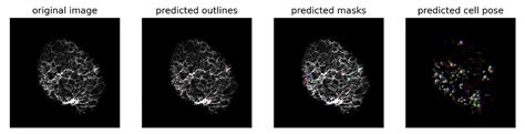 Cellpose Not Segmenting Image Analysis Imagesc Forum