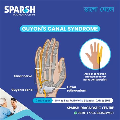 Guyons Canal Syndrome Causes Symptoms Diagnosis And Treatment Sparsh Diagnostic Center