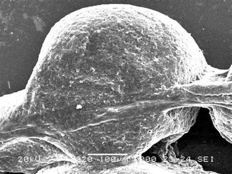Gametes Of Termedia Under Dissection Microscope Download