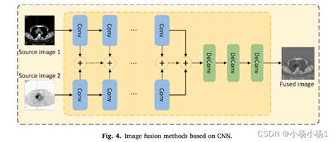 医学图像融合的深度学习方法综述医学图像融合综述 Csdn博客