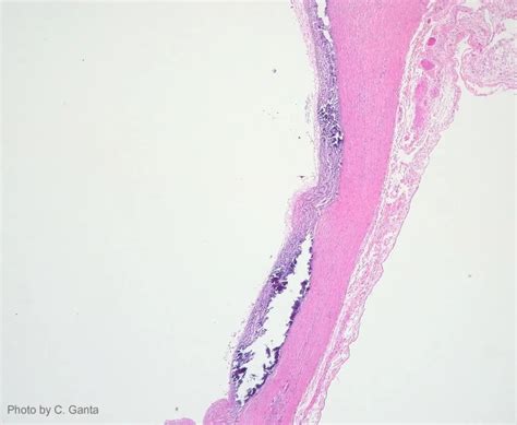 Diffuse Soft Tissue Mineralization In A Cat Veterinary Pathology