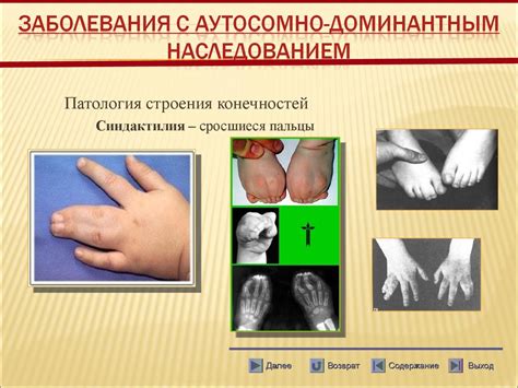 Генетика человека Генные болезни презентация онлайн