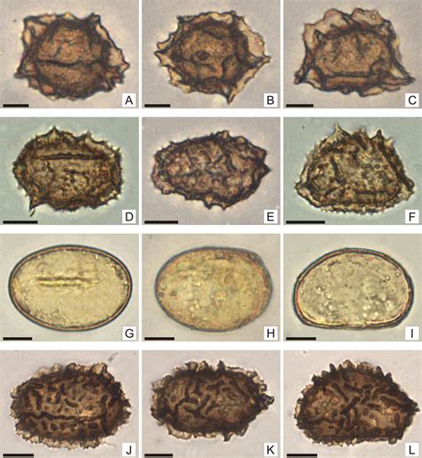 Spores Of Asplenium Sellowianum Asplenium Ulbrichtii Blechnum Download Scientific Diagram