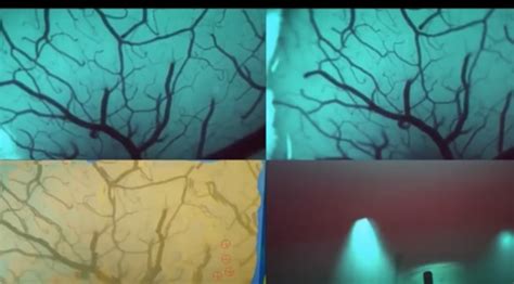 Neuralink And Elon Musk Have 10 000 Electrode Thread Brain Computer Interface