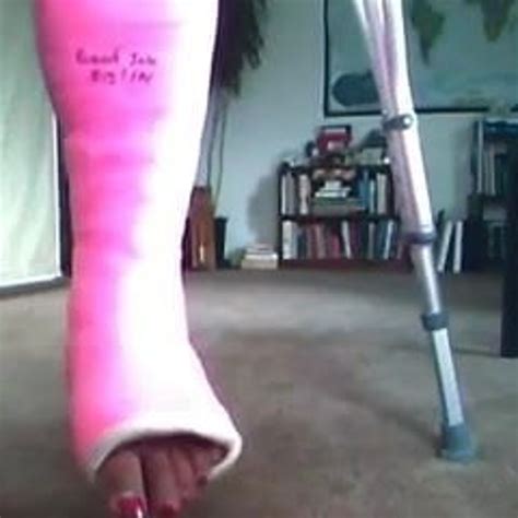 Cast Fetish Broken Ankle Free Free Fetish Tubes Porn Video XHamster