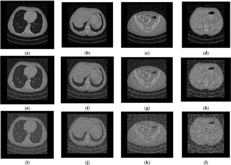 Figure 11 From A Multiple Medical Image Encryption Method Based On Sha