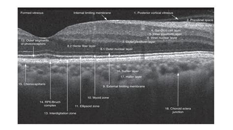 Layers Of Retina Over Oct And Histologypptx