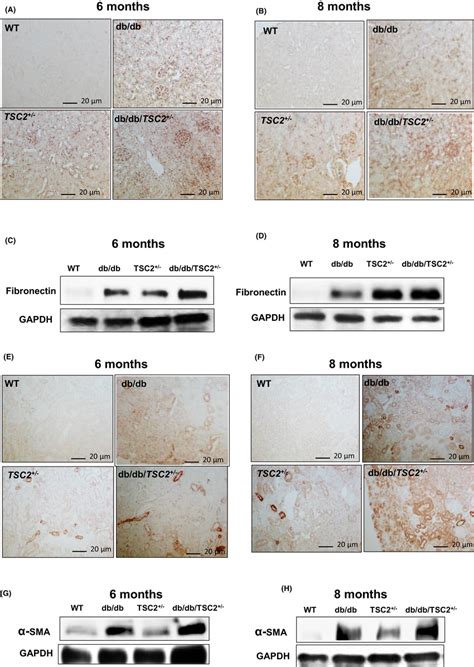 α‐sma and fibronectin are significantly increased in db db tsc2 −