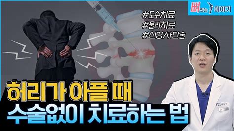 허리통증에 좋은 비수술적 치료방법 소개 나에게 맞는 허리 치료 방법은물리치료도수치료주사치료신경차단술 Youtube