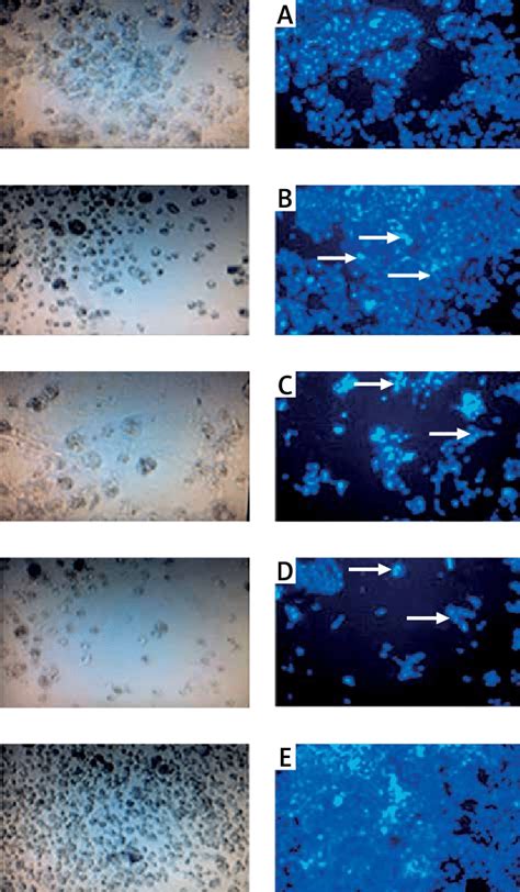 Photographic Record Of Dapi Stained Apoptotic Cells After Plasma Download Scientific Diagram