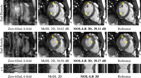 Accelerated Parallel Mri Using Memory Efficient And Robust Monotone