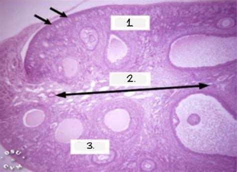 Female Reproductive System Lab Practical Flashcards Quizlet