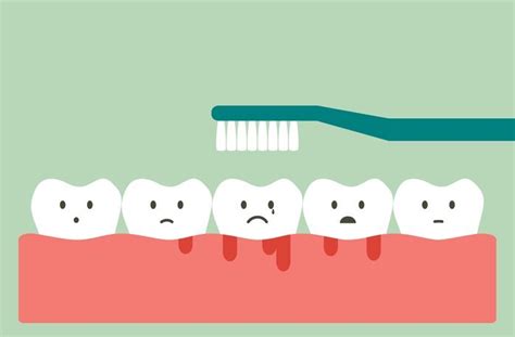 Bleeding Gums And Oral Health Signature Smile