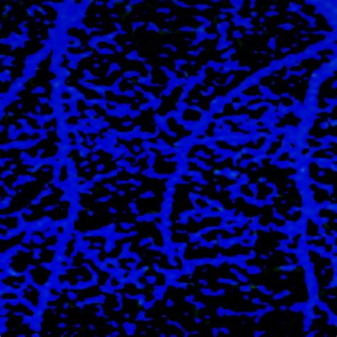 Retinal Oct And Octa Data Raw Kaggle