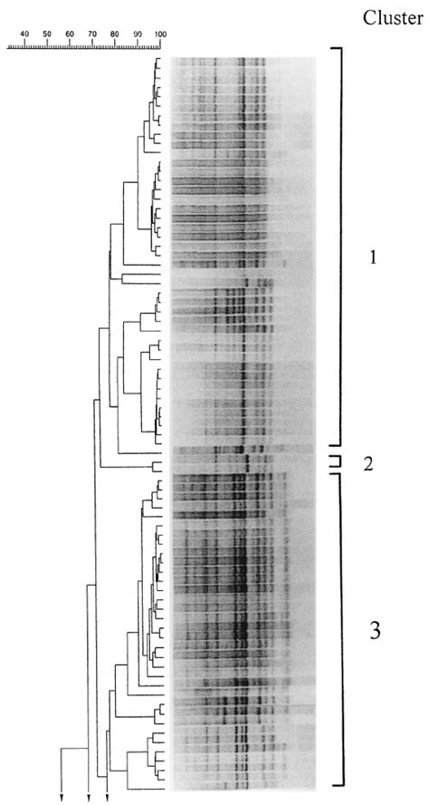 Rapd Pcr Patterns Of V Vulnificus The Dendrogram Was Derived From An