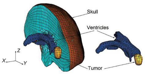 Figure From Review On Finite Element Material Modelling Of Brain Tissue For Surgical