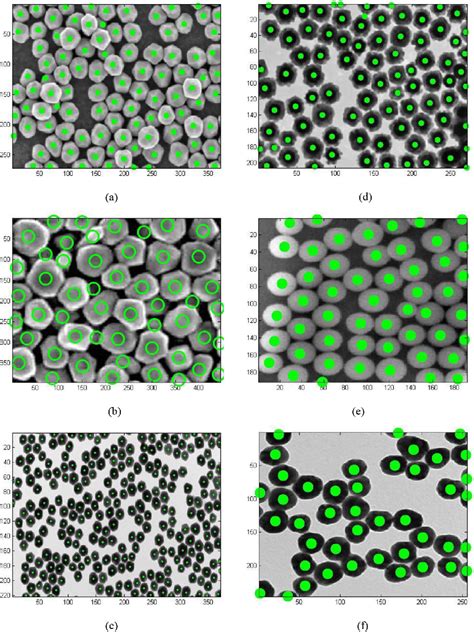 Figure 7 From A New Approach For Segmentation And Quantification Of Cells Or Nanoparticles