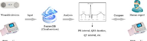 Figure 1 From Accuracy Of Wearable Ecg Parameter Calculation Method For