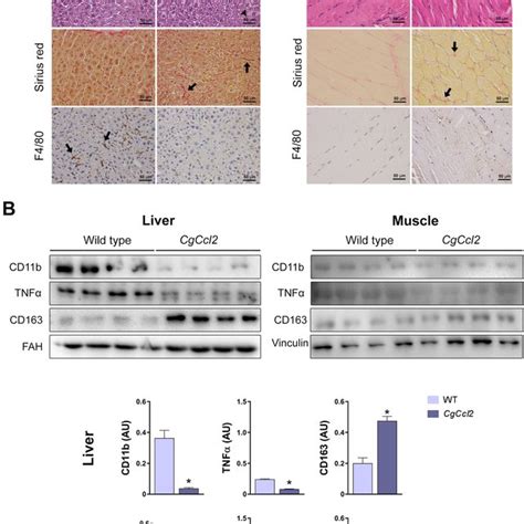 Ccl2 Overexpression Induces Histological Alterations In The Liver And
