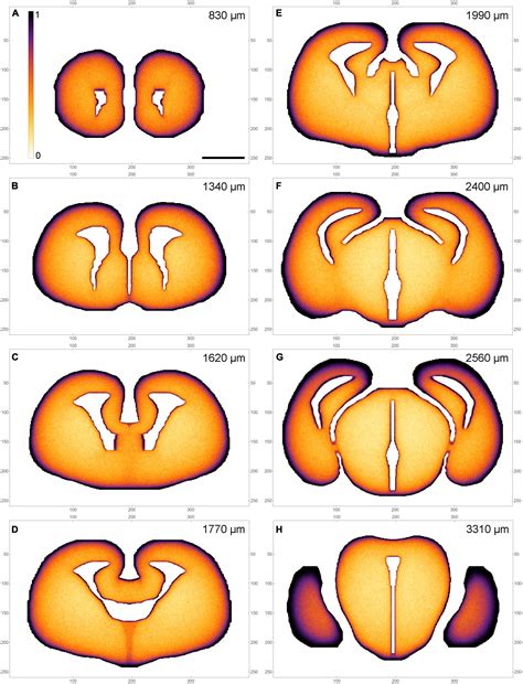 Frontiers Predicting The Distribution Of Serotonergic Axons A