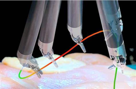 논문 리뷰 Autonomous Image To Grasp Robotic Suturing Using Reliability