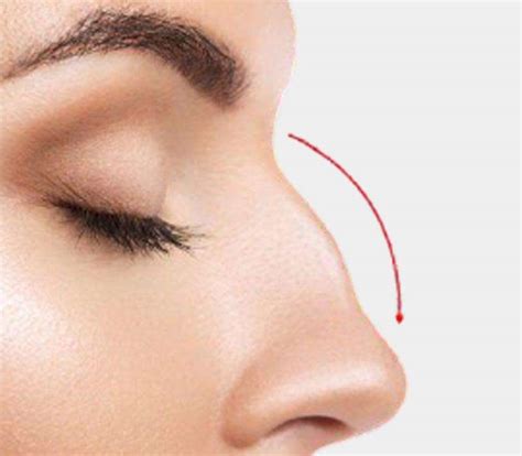 Nose Reshaping Surgery Clinic In Jodhpur Nose Plastic Surgery Services In India