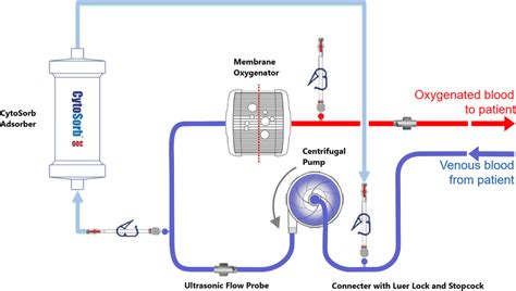 Diagram Of Cytosorb Incorporation Into The Vv‐ecmo Circuit