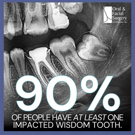 Dr Craig Wooten Oral And Facial Surgery Of Oklahoma Word Of The Day Osseointegration 🦴