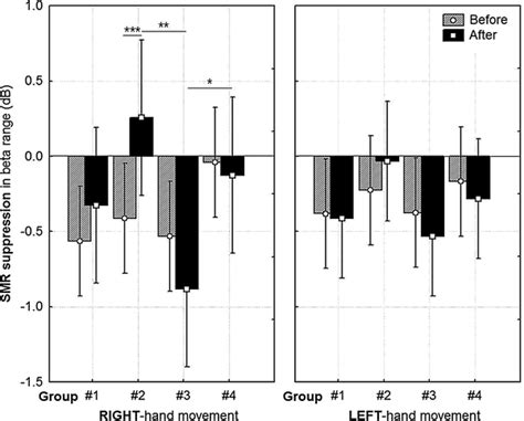 Differences In Desynchronization Of β Bands 1330 Hz Related To The