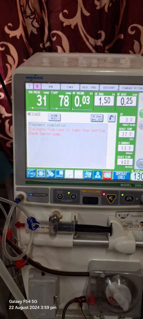 Balram Verma On Linkedin Today Work In Dialysis Machine Dialysate Flow Rate Alarm Clean Duplex