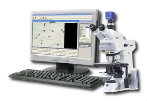 Automated Semen Analyser Automated Sperm Analyzer Latest Price Manufacturers And Suppliers