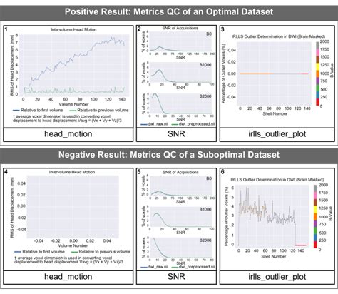 Pydesigner V10 A Pythonic Implementation Of The Designer Pipeline For