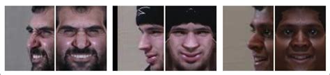 improving facial expression synthesis through gan based frontalization