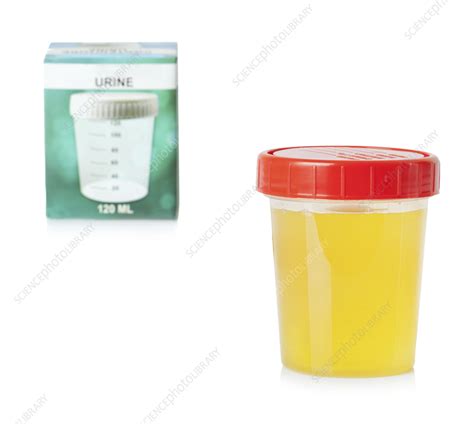 Urine Sample Stock Image F0440672 Science Photo Library