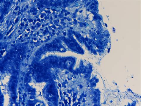 Giemsa Stain Helicobacter Pylori