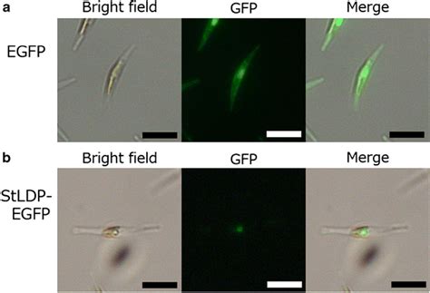 Subcellular Localization Of Stldpegfp Fusion Protein Microscopic