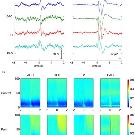 Trial Averaged Local Field Potentials Lfps Show Persistent Power Download Scientific Diagram